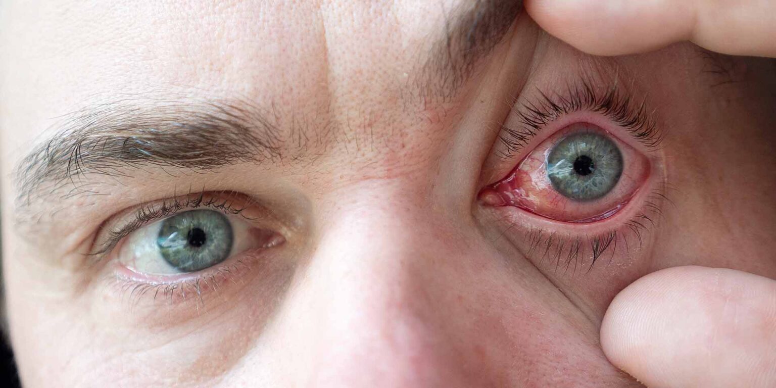 Examen de fondo de ojo: ¿Por qué es importante? - Futuro Visión